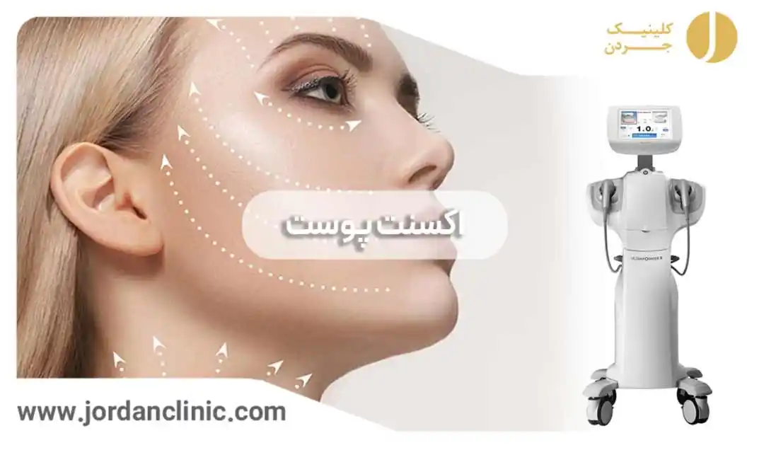 اکسنت پوست یا رادیوفریکوئنسی RF؛ فرآیند، کاربرد و مزایا | کلینیک جردن